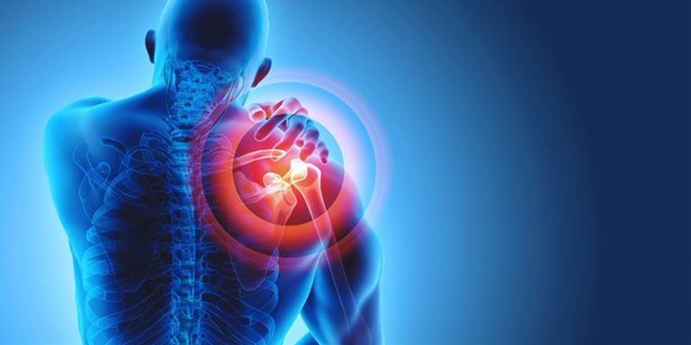 Tendinopatia della spalla: cause e trattamenti - Universal Kinesiology